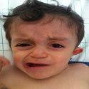 Patient with CHARGE syndrome
