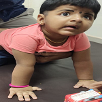 Rubinstein-Taybi syndrome: a rare case report of a female child ...
