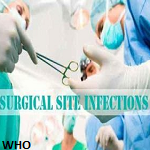 Effectiveness of preoperative bath using chloroxylenol antiseptic soap ...