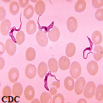 Human African trypanosomiasis (HAT) in the Republic of Congo: why the ...